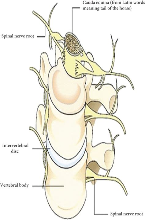 A Normal Intervertebral Disc And Spinal Nerve Root B Degenerated