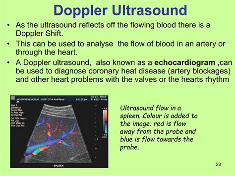 Ultrasound Powerpoint Presentation Radio Ppt