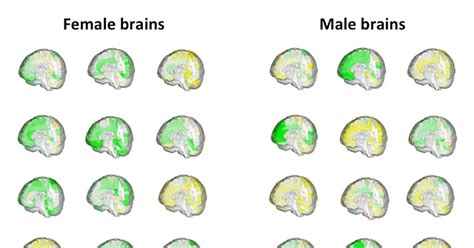 Can You Tell Which Brains Are Male Neither Can These Scientists