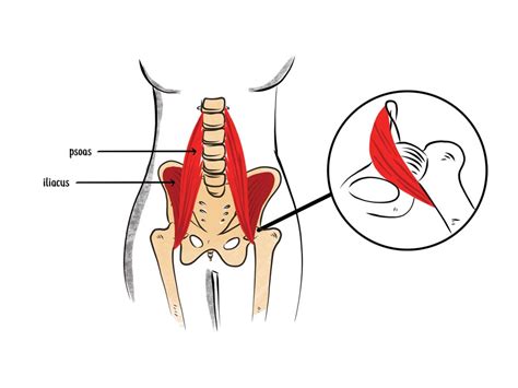 Ultimate Guide To The Iliopsoas What It Does Why It Hurts And What