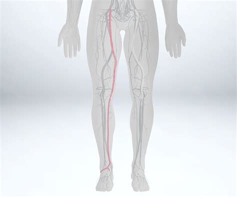 Cryovein® Saphenous Vein Artivion