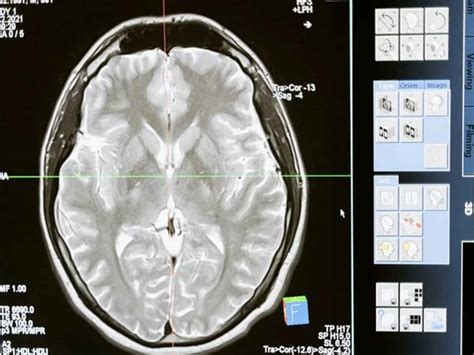 Chatgpt Bard Like Ai Tool To Turn Peoples Thoughts Into Text