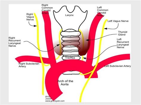 Recurrent Laryngeal Nerve Paralysis