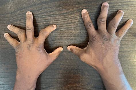 Jeff Herrod Feels Forgotten ‘no One Acknowledges The Work We Did The Athletic