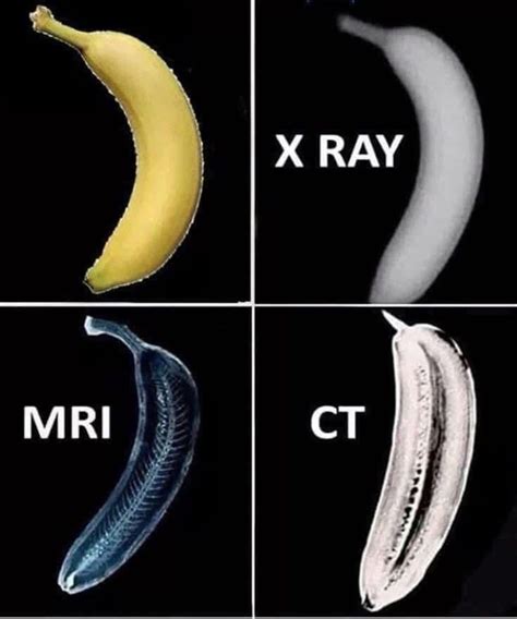 Маралгоо ☝️Нурууны өвчнийг оношлоход ️Рентген зураг ️МРА зураг ️Компьютерт томографи Ct
