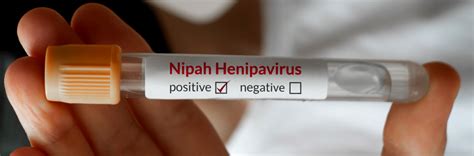 Kerala On Alert After Two Nipah Virus Deaths