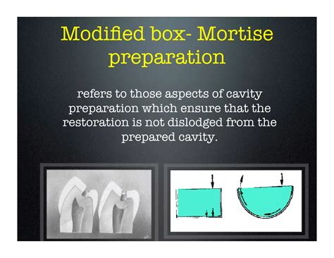 Amalgam Cavity Preparation Class I Pdf