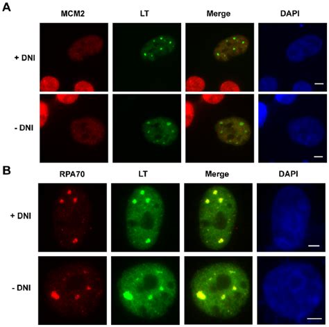 The Mcv Replication Complex A The Host Helicase Mcm2 Does Not