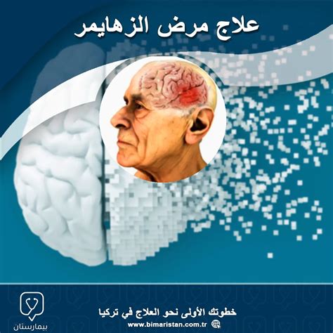 علاج مرض الزهايمر العصبي في تركيا والوقاية منه بيمارستان