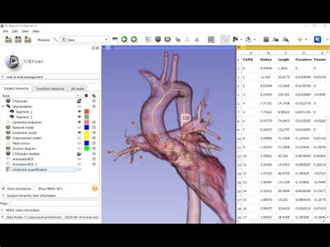 New Module Extract Centerline In SlicerVMTK Extension Support 3D