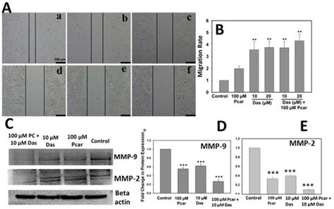 Synergistic Anti Tumor Effect Of Palmitoylcarnitine And Dasatinib In Liver Cancer