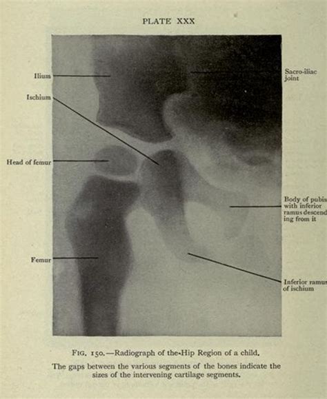 Anatomically Labelled X Ray Images 1920 Artofit
