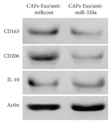 Exo Mirna 320a Facilitated Macrophage M2 Polarization Qpcr Analysis Of
