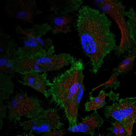 Subcellular Location Of Egfr The Human Protein Atlas