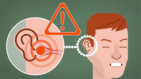 How To Clean Your Ears 14 Steps With Pictures WikiHow