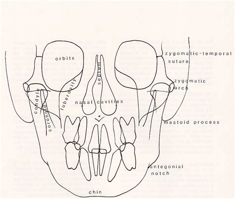 Cephalometric Analysis Cephx