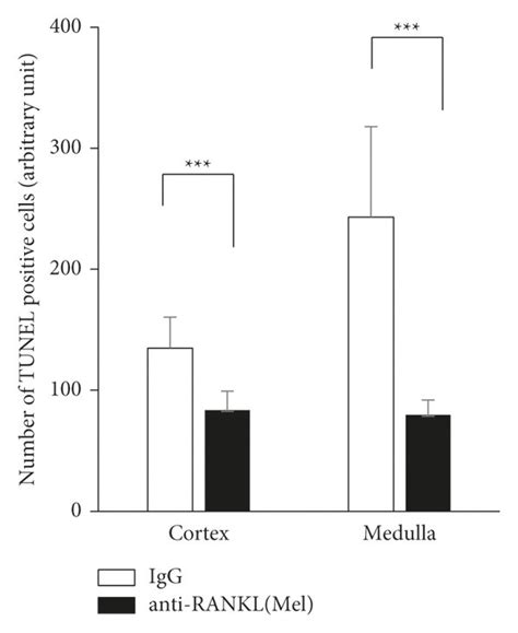 Immunochemical Examination And Tunel Assay Of The Thymus A The Upper