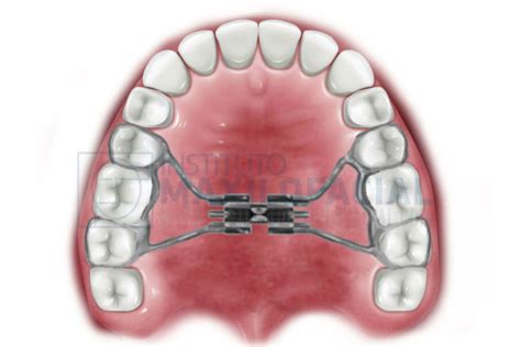 What Is Sarpe Instituto Maxilofacial