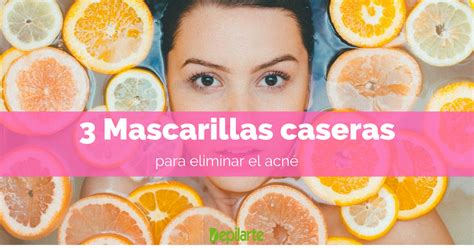 3 Mascarillas caseras para eliminar el acné