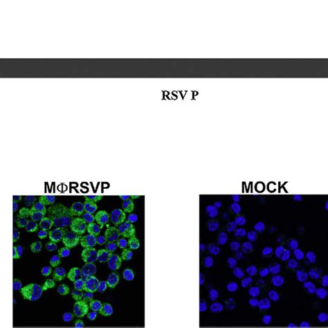 Cloning And Transfection Of Rsv P Protein Into Macrophages Panel A