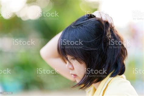 Women Have Itchy Head Due To Dandruff Or Scalp Dermatitis Health Care