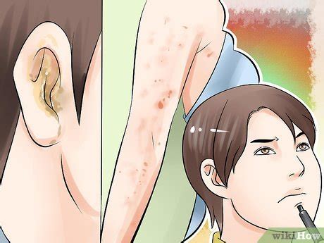 Cara Mengobati Infeksi Pseudomonas 15 Langkah Dengan Gambar