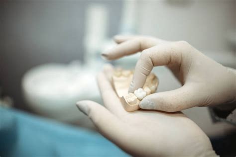 Implante Dentário Todos Os Dentes Dr Alexandre Lemos