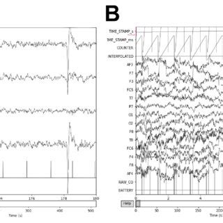PDF Remote Collection Of Electrophysiological Data With Brain Wearables Opportunities And