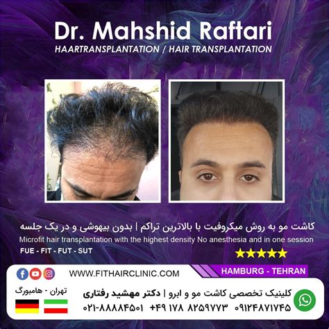 Gallery کلینیک تخصصی کاشت موی دکتر رفتاری