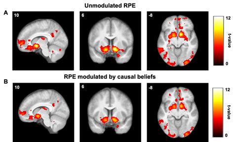 Reward Prediction Errors Group Level Statistical Maps From Glm 1 A Download Scientific