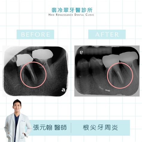 Dr 林葳牙科診療室 分享診所張元翰醫師的患者案例