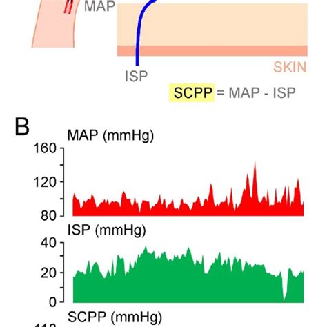 Monitoring From The Injured Spinal Cord A Pressure Probe At The Injury