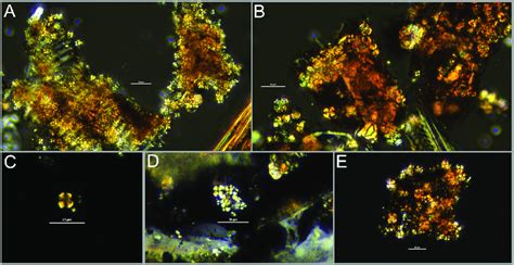 Photographs Of Spherulites Within A Modern Uncharred Gazelle Gazella