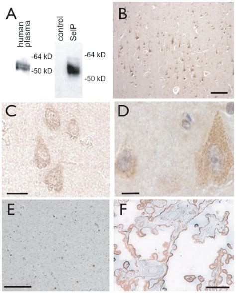Figure 1 From Association Of Selenoprotein P With Alzheimers Pathology