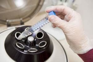 How Long Can Sperm Live After Intercourse Inside The Body Iytmed Com