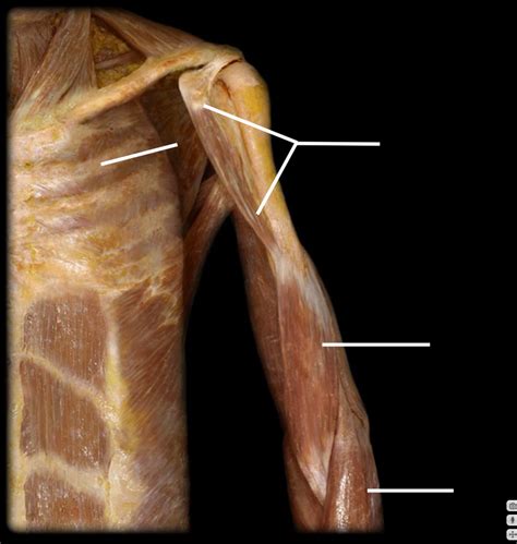 Anterior Third Layer Deep Muscles Of The Upper Limbs And Shoulder