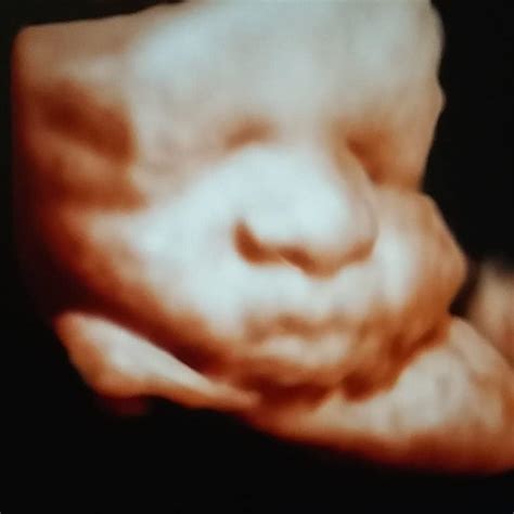 2d 3d4d And 5dhd Pregnancy Ultrasounds Life Scan Studio