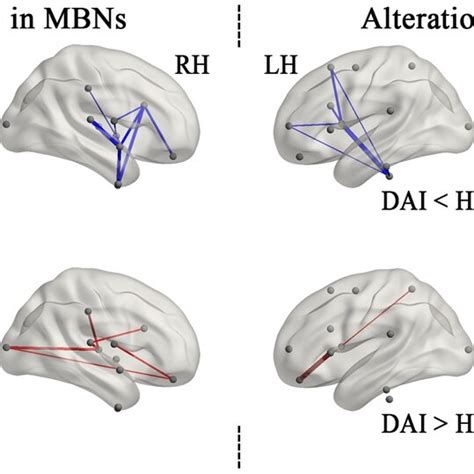 Dai Related Alterations In The Network Connections In Mbns And Fbns