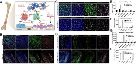 Siglec 15 Sialic Acid Axis As A Central Glyco Immune Checkpoint In Breast Cancer Bone Metastasis