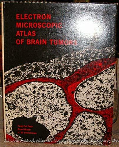 Electron Microscopic Atlas Of Brain Tumors Poon Tung P