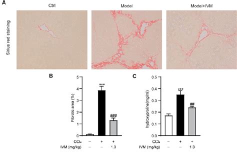 Figure 2 From Ivermectin Attenuates Ccl4 Induced Liver Fibrosis In Mice