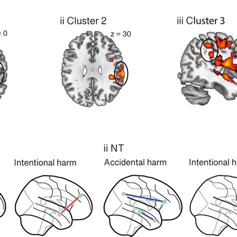 Fmri Results A Task Related Results Clusters Spanning Download