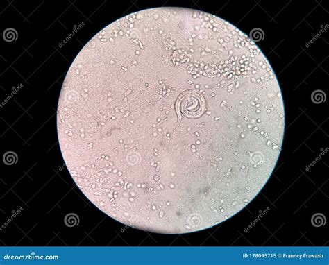 Staphylococcus Saprophyticus Sample Culture Microbiology Royalty