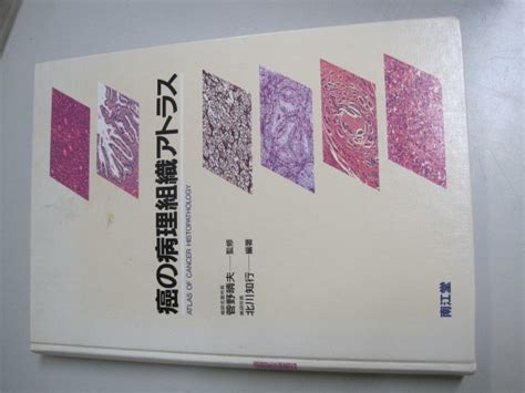 癌の病理組織アトラス Atlas Of Cancer Histopathology 菅野晴夫 監修 北川知行 編著 南江堂 1995 G073