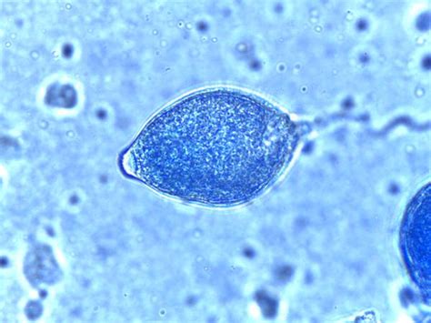 Phytophthora Infestans Microscope