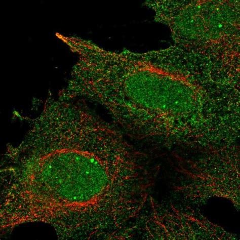 Rabbit Polyclonal Anti Ralbp1 Antibody Buy For Research Highly