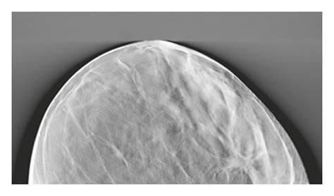 Preprocessing Effects A Original Image And B Preprocessed Image