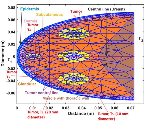 Schematic Diagram Of 2 D Discretization Of Breast Tissue With Tumors