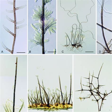 Codinaea Fertilis Daom 93548c Isotype A Substrate With Colonies
