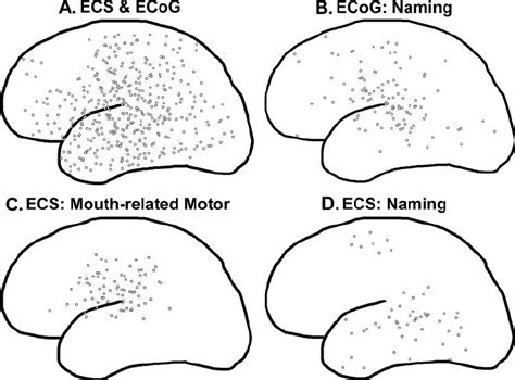Spatial Distribution Of Ecog And Ecs Maps From All 13 Patients In